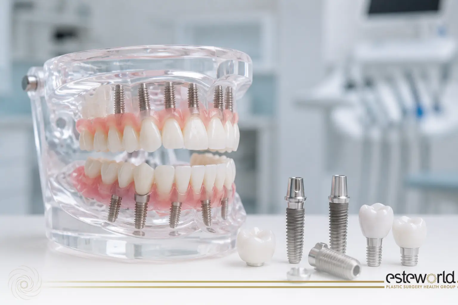 How Much Does a Full Mouth of Implants Usually Cost?
